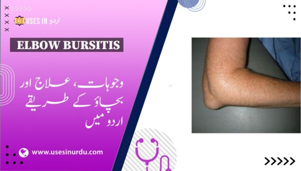 Elbow Bursitis – Uses in Urdu